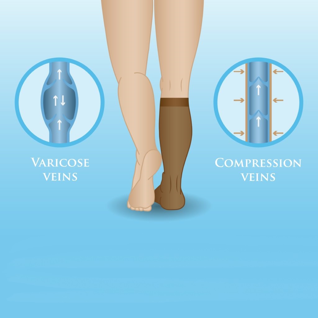 How To Put On Compression Socks - Best Guide For 2023